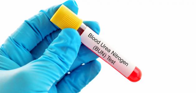 What Is The Analysis Of Urea In The Blood
